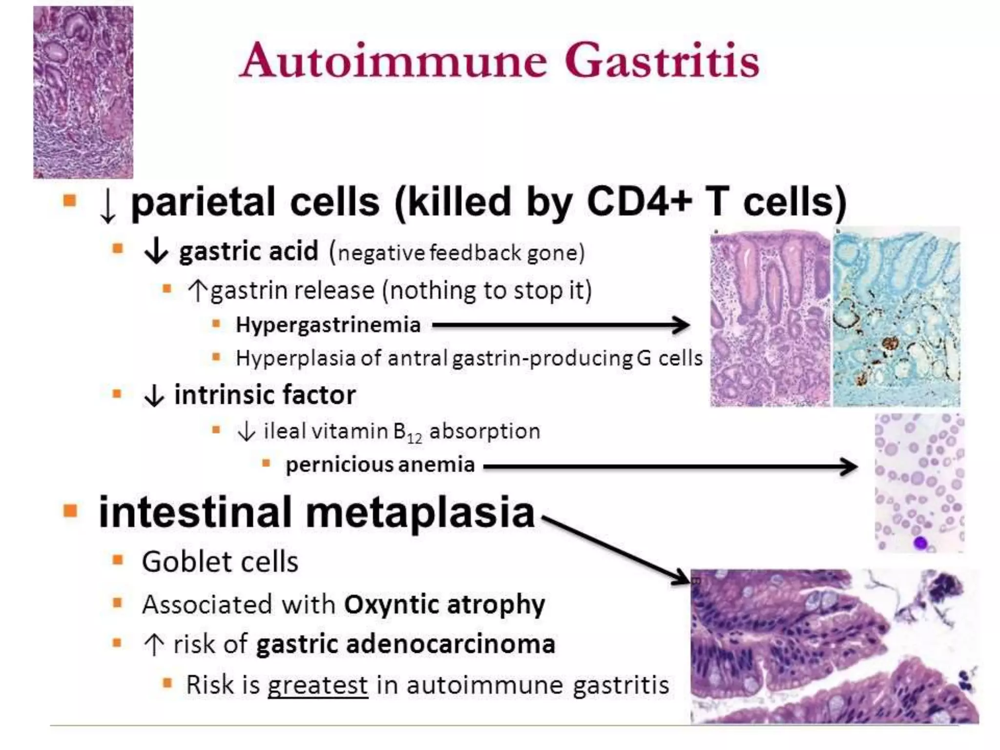 Chronic Gastritis Pathology | PPTX