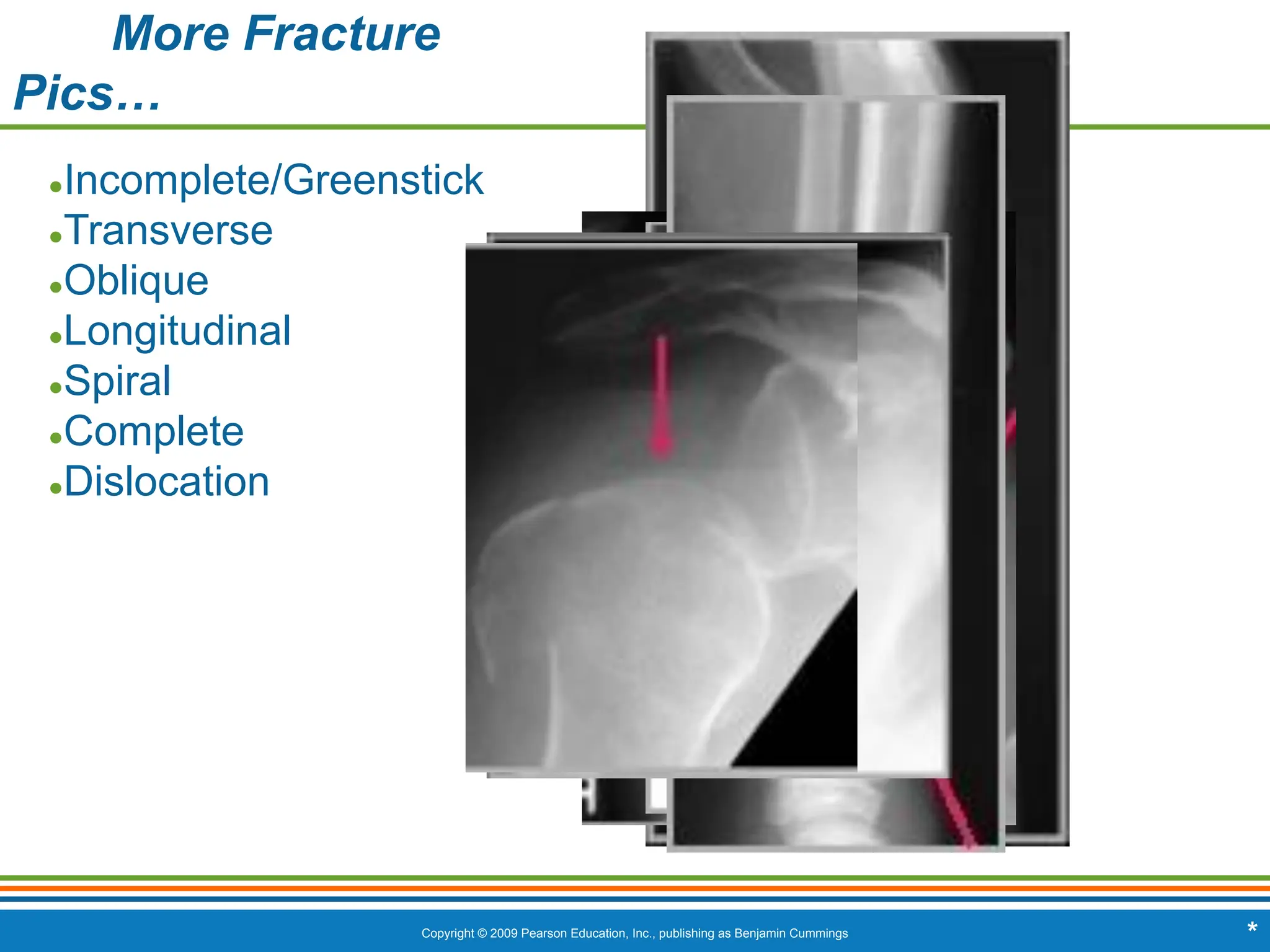 Ch. 5 Lecture - Skeletal System (marieb).ppt.pdf