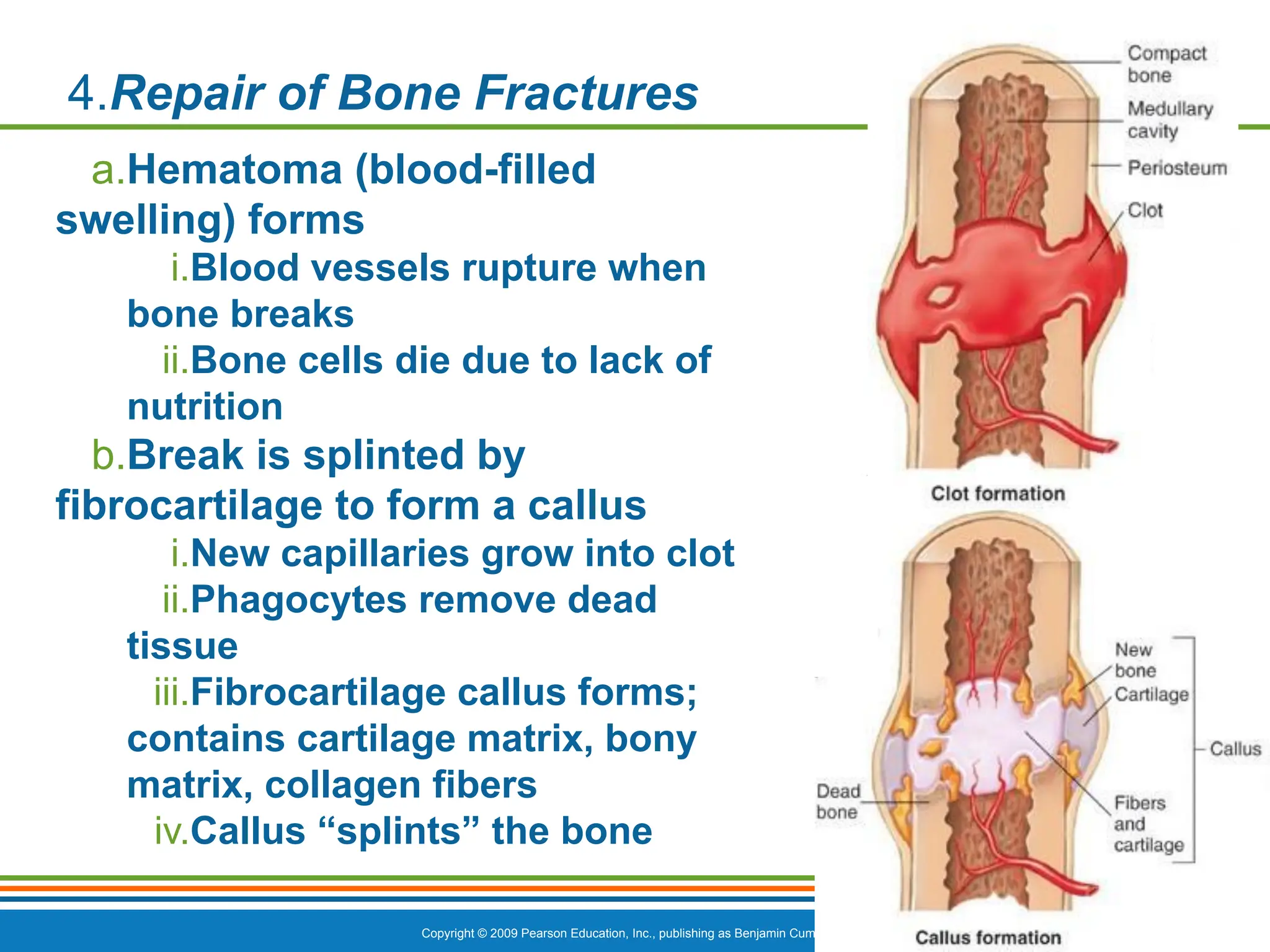 Ch. 5 Lecture - Skeletal System (marieb).ppt.pdf