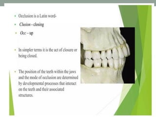 Ch-3 Occlusion & Malocclusion Classification.pdf