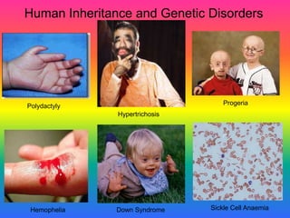 Ch. 4 human inheritance and genetic disorders [new] | PPTX | Blood ...