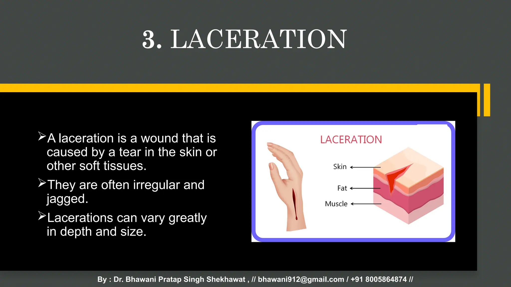ch-7 class 12th physiology and injuries in sports.pptx