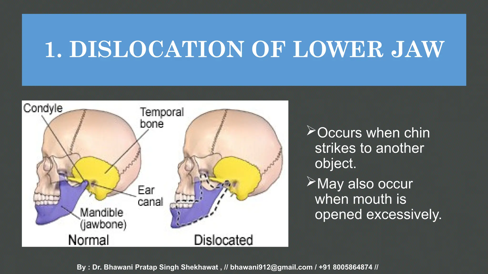 ch-7 class 12th physiology and injuries in sports.pptx