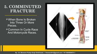 ch-7 class 12th physiology and injuries in sports.pptx