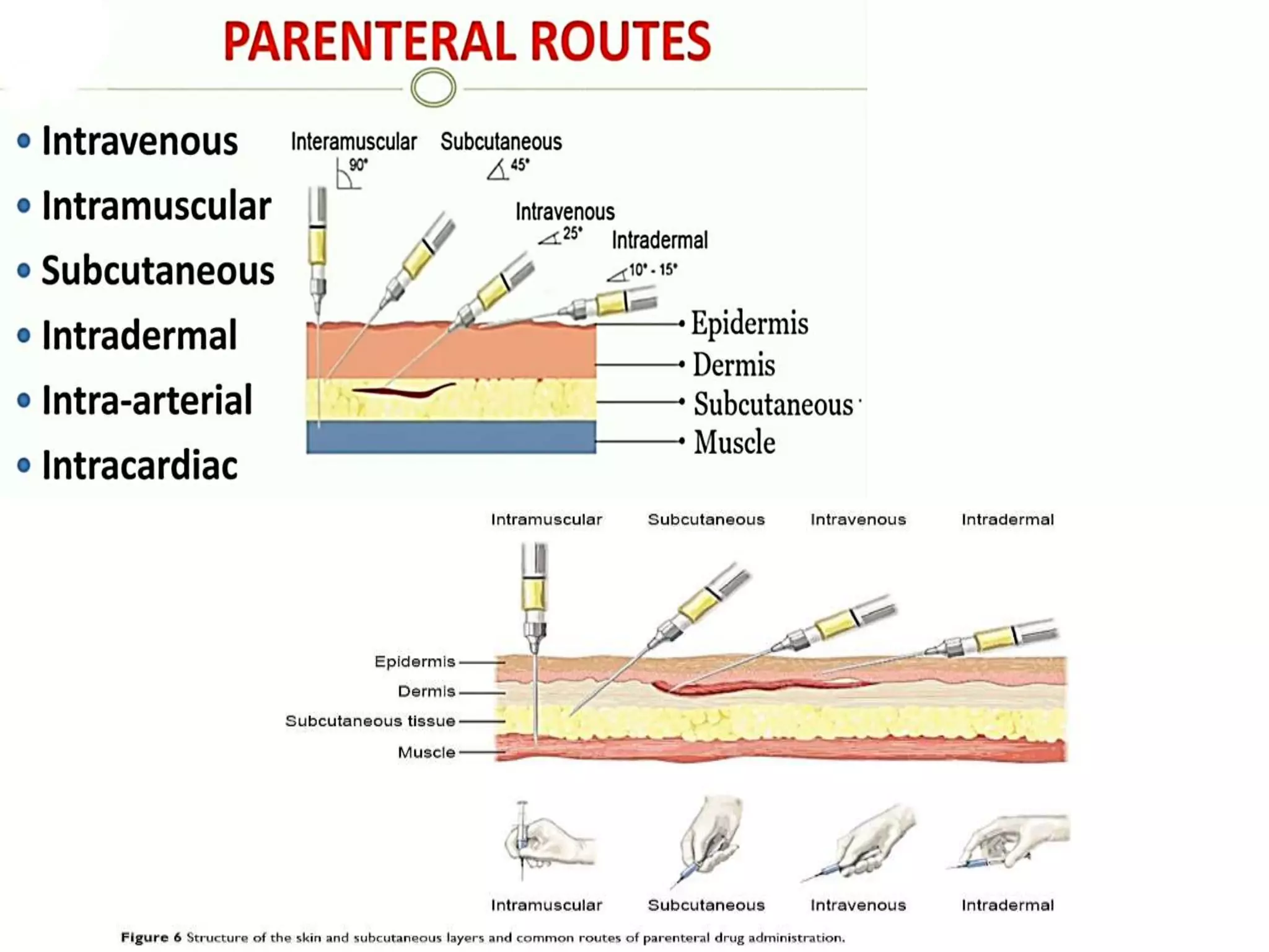 Ch parenteral dosage form & its classification | PPTX