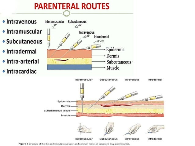 Ch parenteral dosage form & its classification | PPTX