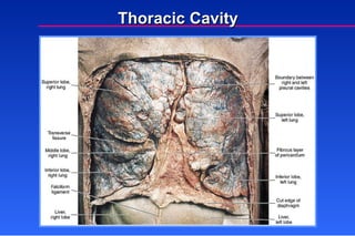Costodiaphragmatic Recess Dog