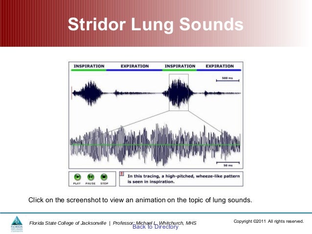 Ch04 ln no-crs_respiratory_wo video