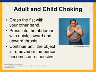 Ch05 presentation cpr | PPT