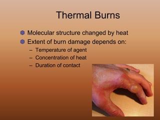 Phenol Burn