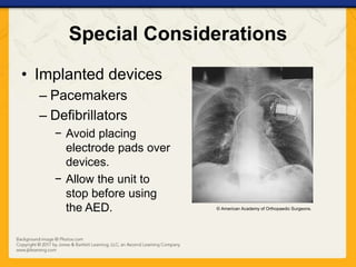 Ch06 presentation aed | PPT