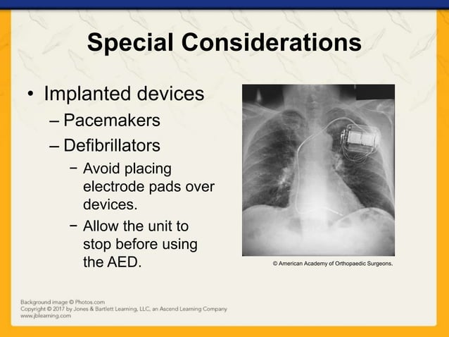 Ch06 presentation aed | PPT