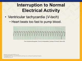 Ch06 presentation aed | PPT
