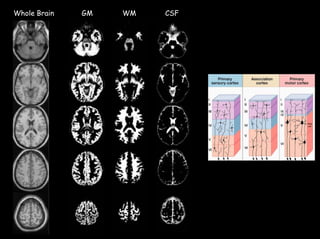 Ch07 | PDF | Brain and Nervous System Disorders | Diseases and Conditions