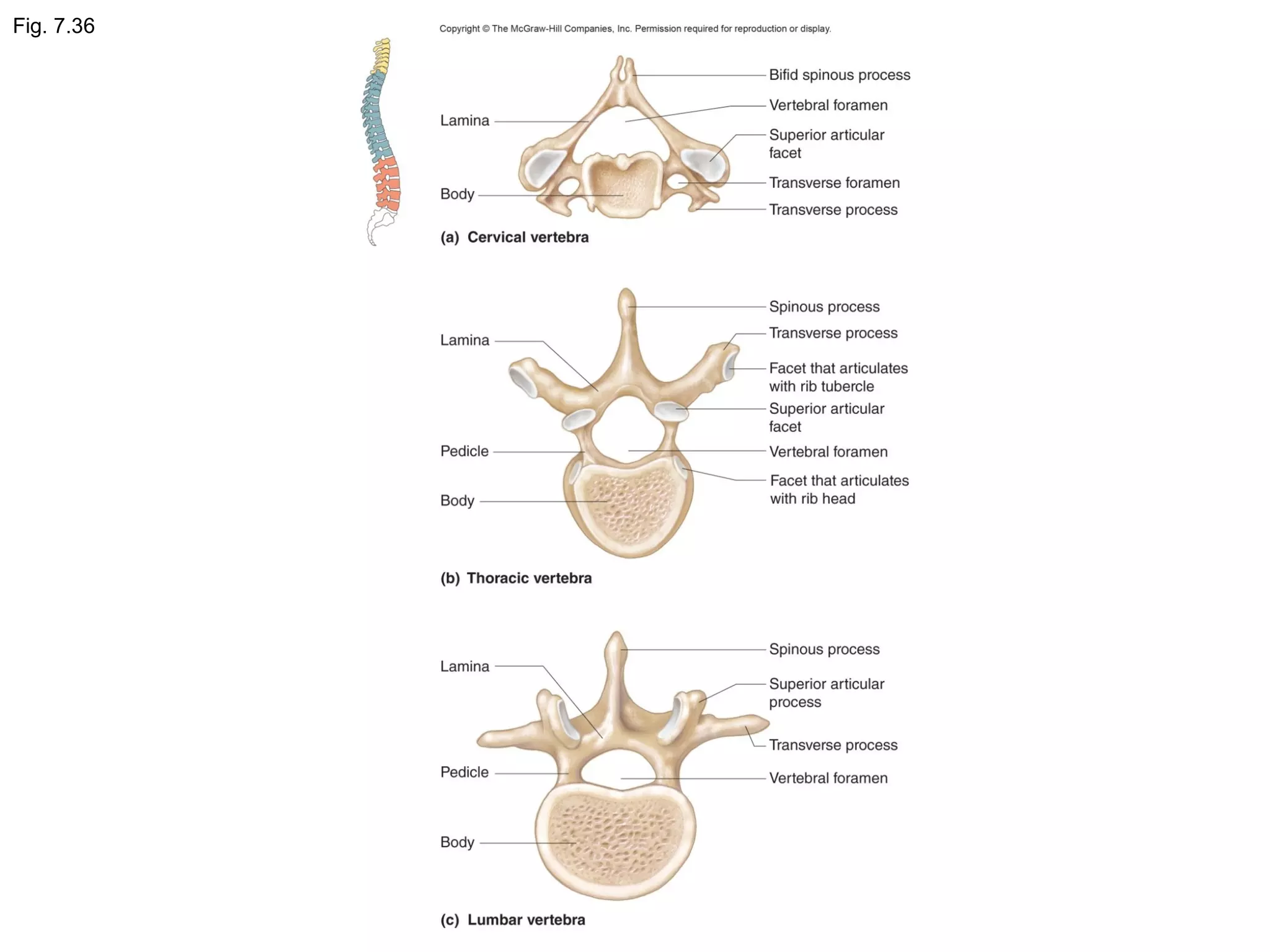 Chapter 7: Skeletal System Hole's Human Anatomy and Physiology | PPT