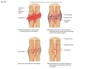 Chapter 7: Skeletal System Hole's Human Anatomy and Physiology | PPT