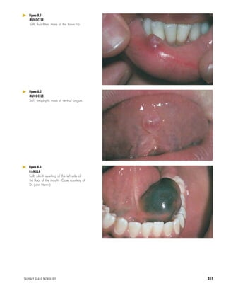 8/14 Salivary Gland Pathology- oral pathology color atlas | PDF ...