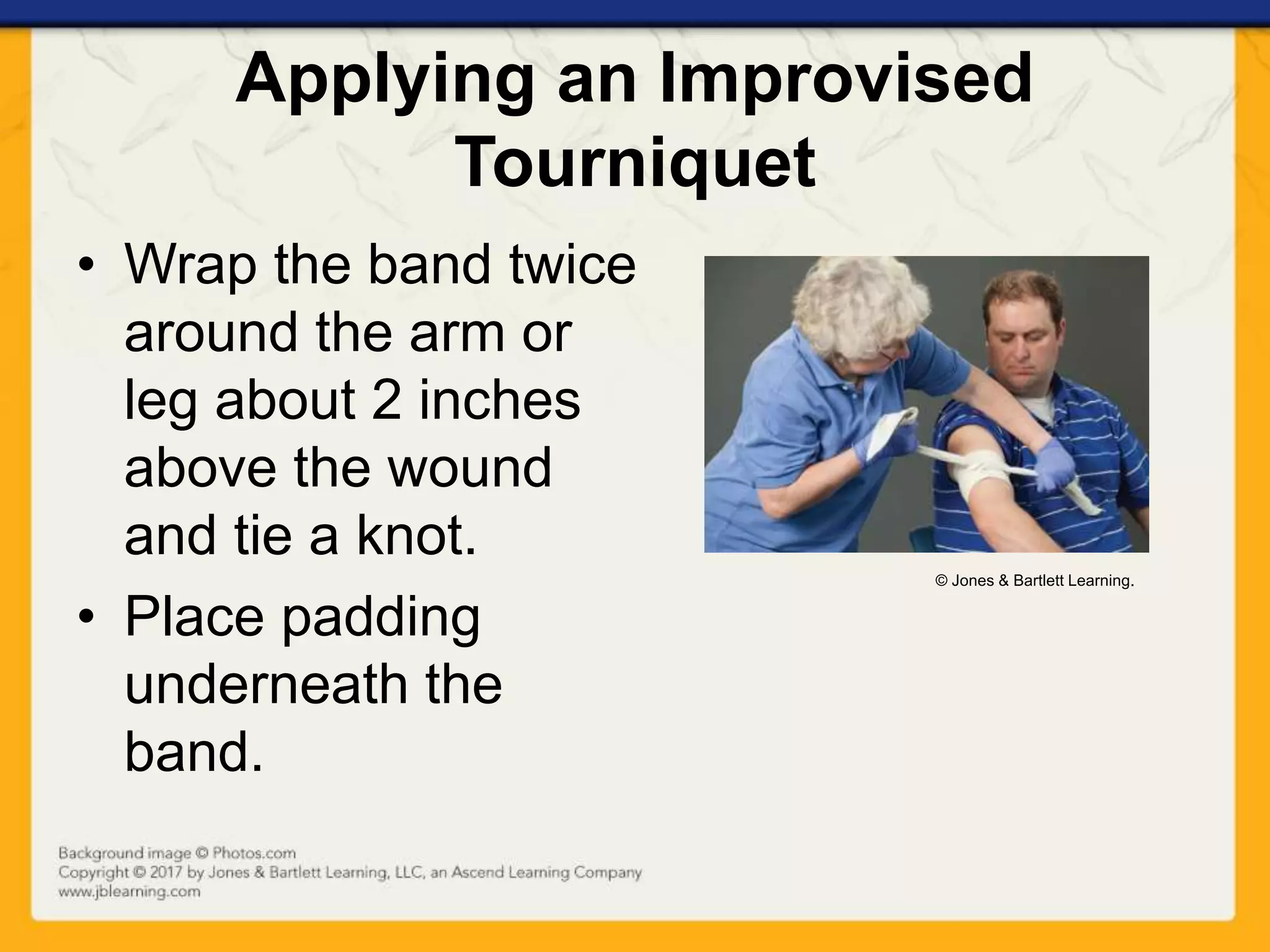 Ch08 presentation bleeding | PPTX