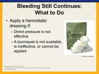 Ch08 presentation bleeding | PPTX