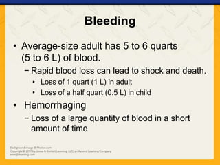 Ch08 presentation bleeding | PPTX