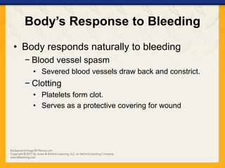 Ch08 presentation bleeding | PPTX