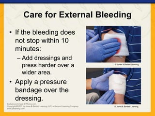 Ch08 presentation bleeding | PPTX