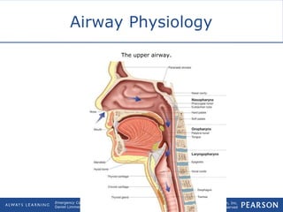 Ch09 airway | PPT