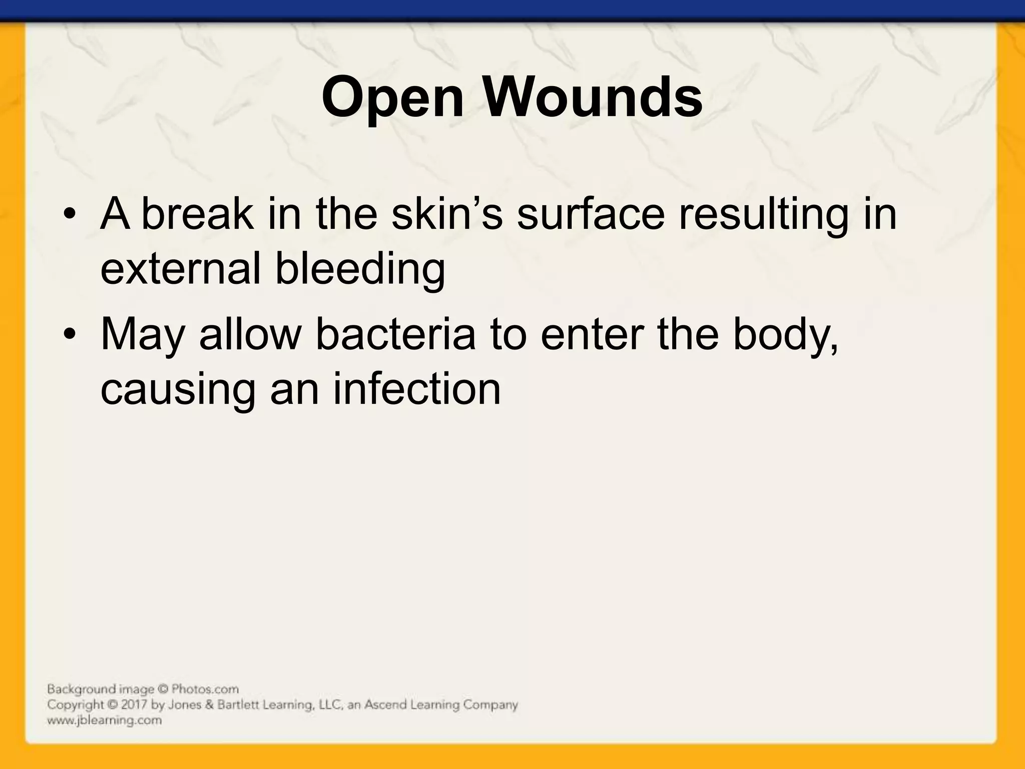 Ch09 presentation wounds | PPTX