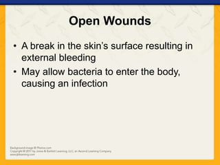 Ch09 presentation wounds | PPTX