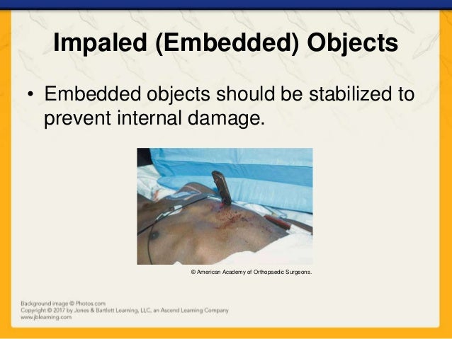 Ch09 presentation wounds