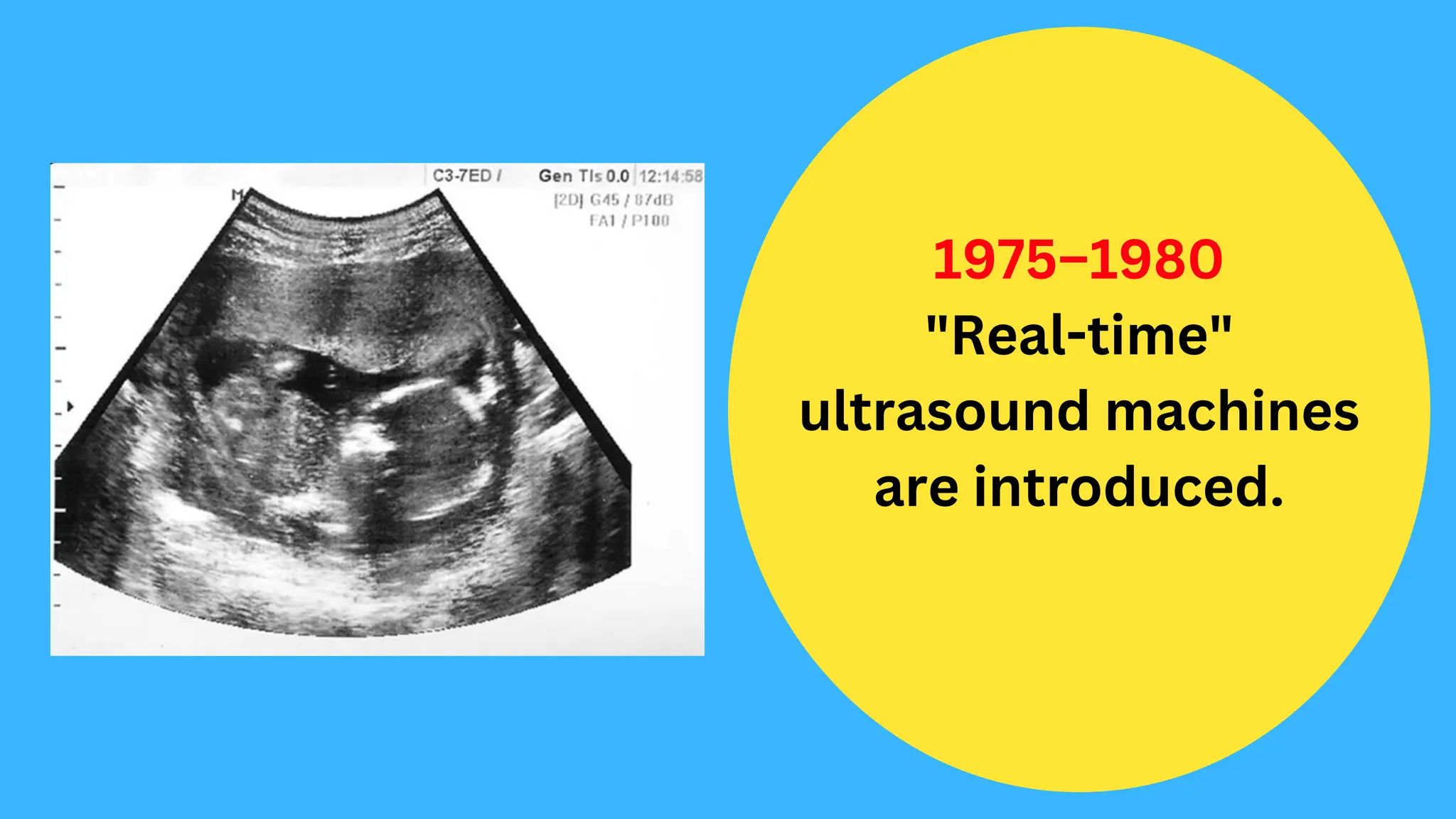 The History of Diagnostic Medical imaging | PDF