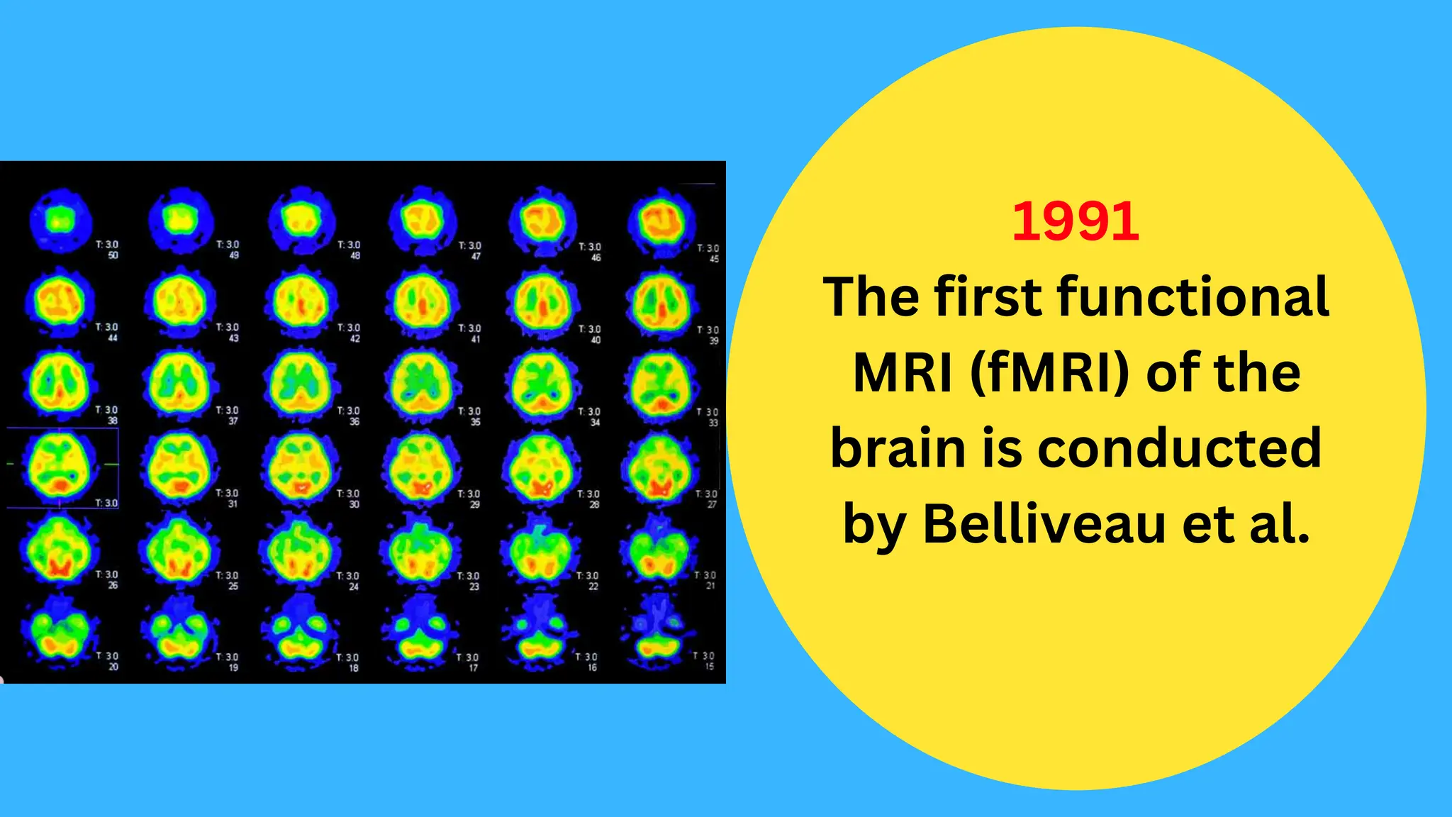 The History of Diagnostic Medical imaging | PDF