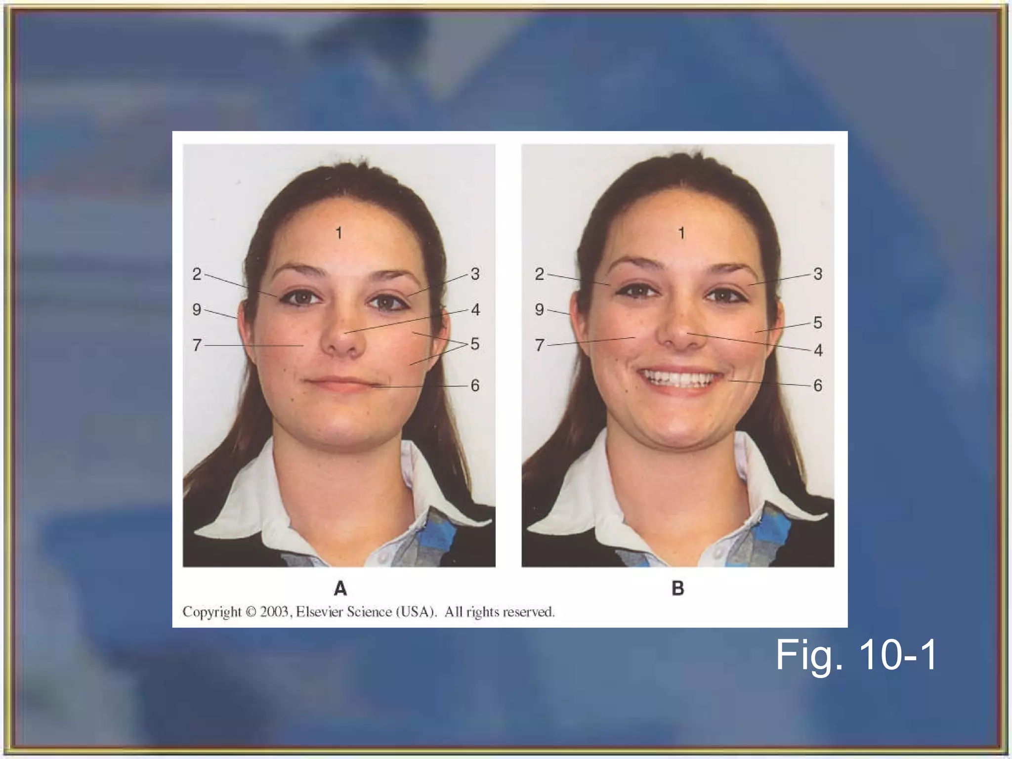 landmarks of face and oral cavity | PPT