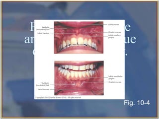 landmarks of face and oral cavity | PPT