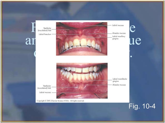 landmarks of face and oral cavity | PPT | Ear, Nose and Throat ...