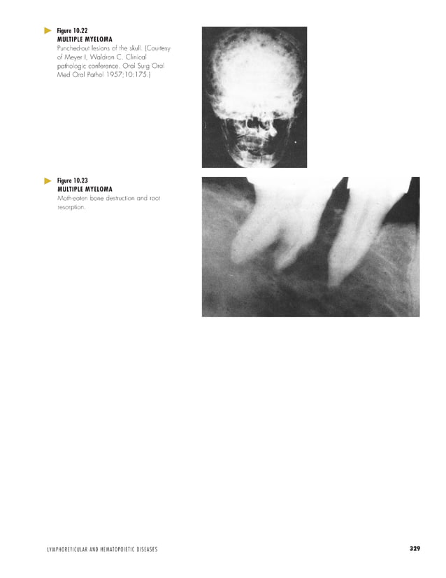 10/14 Lymphoreticular and Hematopoietic Diseases- OP Color Atlas | PDF