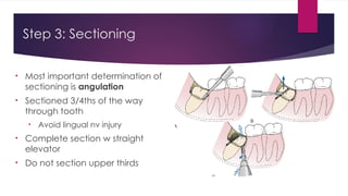 Principles of Management of Impacted Teeth_Mari-Alina_Timoshchuk.pptx