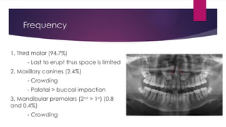 Principles of Management of Impacted Teeth_Mari-Alina_Timoshchuk.pptx