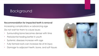 Principles of Management of Impacted Teeth_Mari-Alina_Timoshchuk.pptx