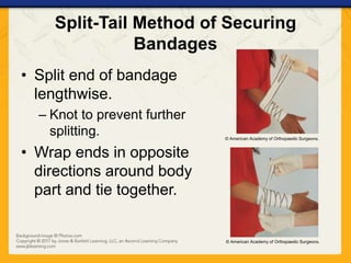 Ch10 presentation bandaging_wounds | PPT