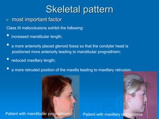 Class III Orthodontics Dentistry by Cezar E. | PDF