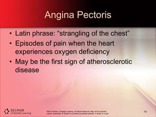 Chapter 11- Angina and Myocardial Infarction | PPTX