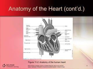 Chapter 11- Angina and Myocardial Infarction | PPTX