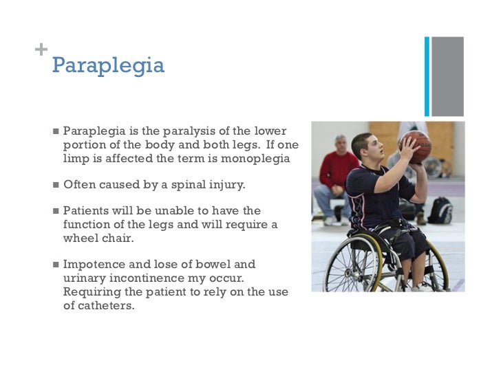 Paraplegia Definition
