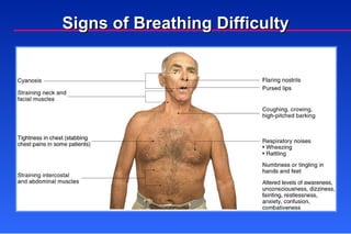 Respiratory Emergencies | PPT