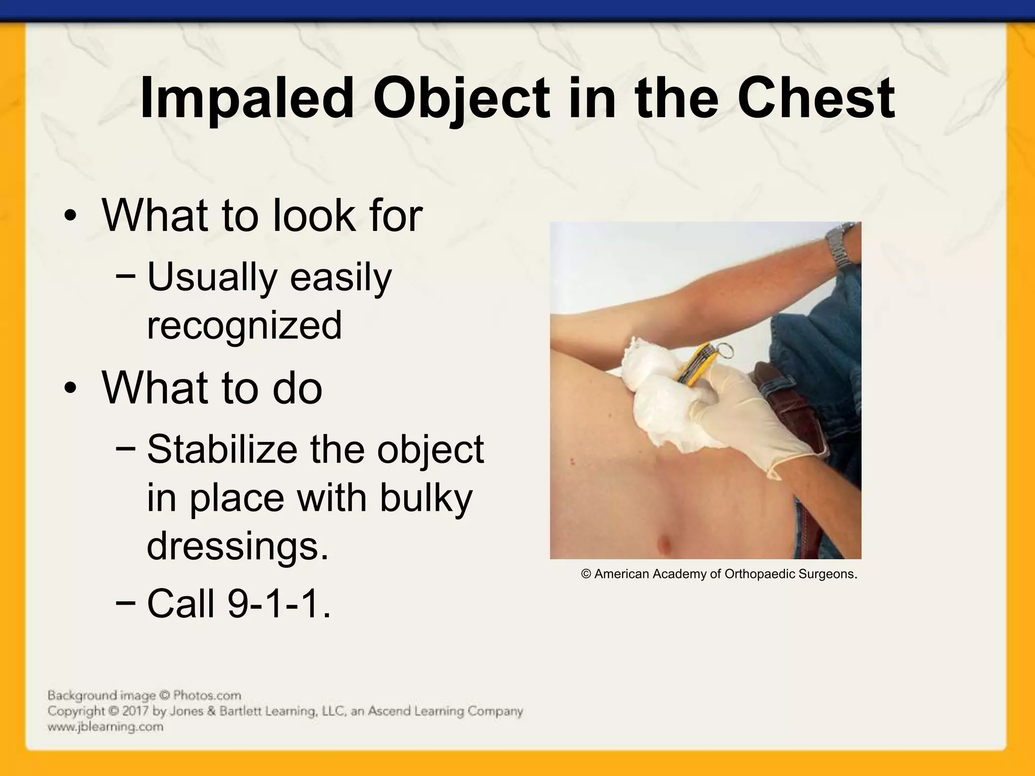Ch13 presentation chest_abdominal_pelvic_injuries | PPTX