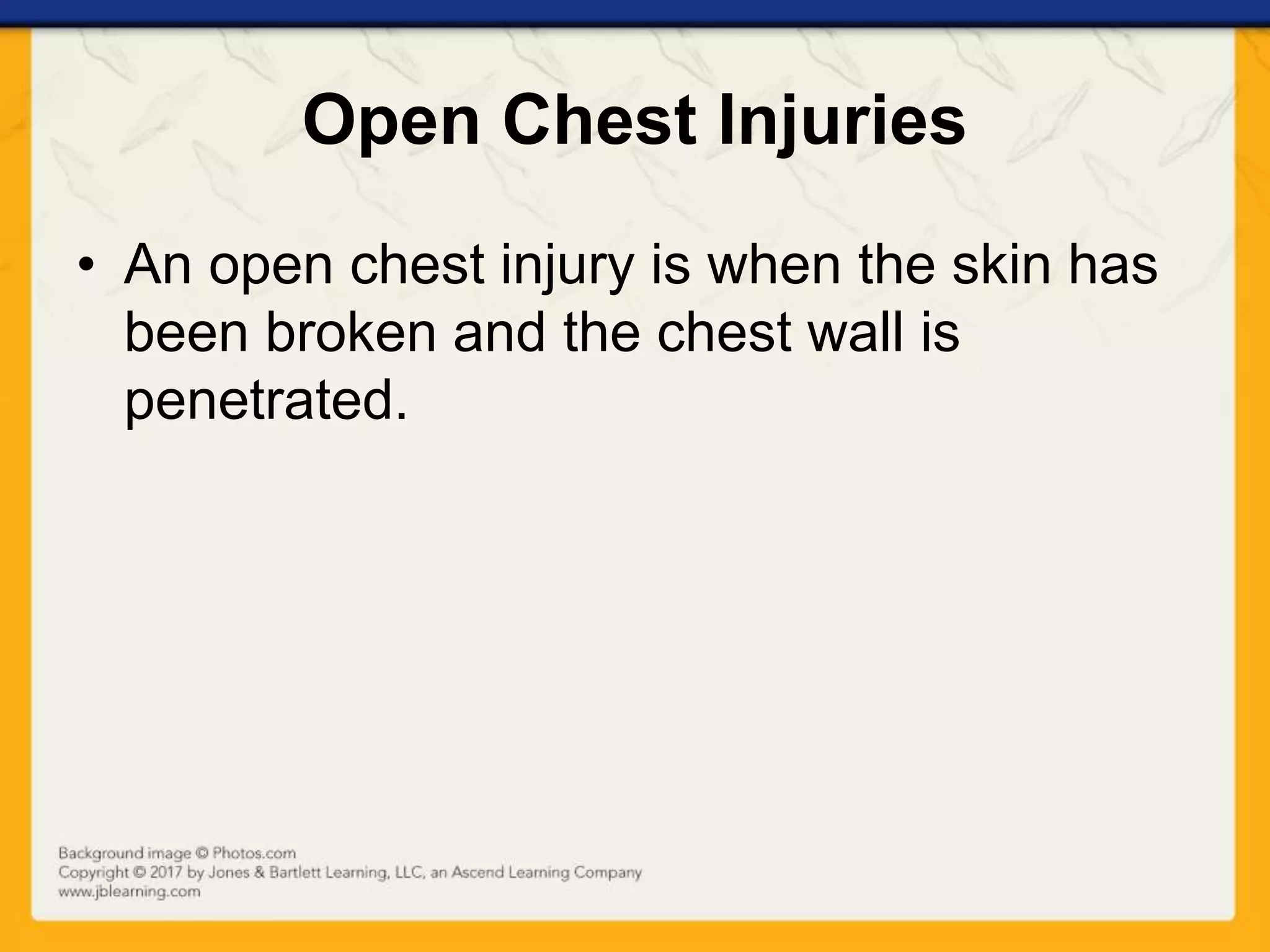 Ch13 presentation chest_abdominal_pelvic_injuries | PPTX