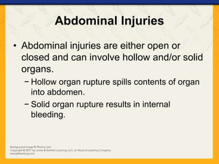 Ch13 presentation chest_abdominal_pelvic_injuries | PPTX