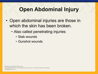 Ch13 presentation chest_abdominal_pelvic_injuries | PPTX