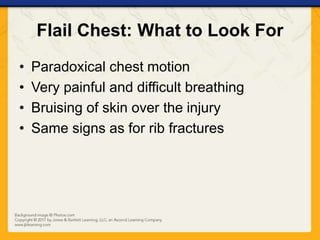 Ch13 presentation chest_abdominal_pelvic_injuries | PPTX